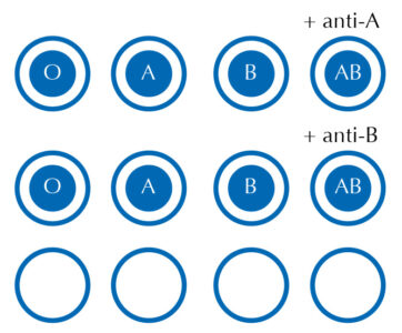 Investigating blood types – Science in School