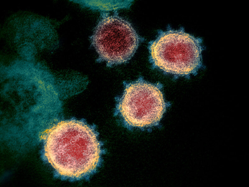 Coronavirus: la ciencia en resumen – scienceinschool.org