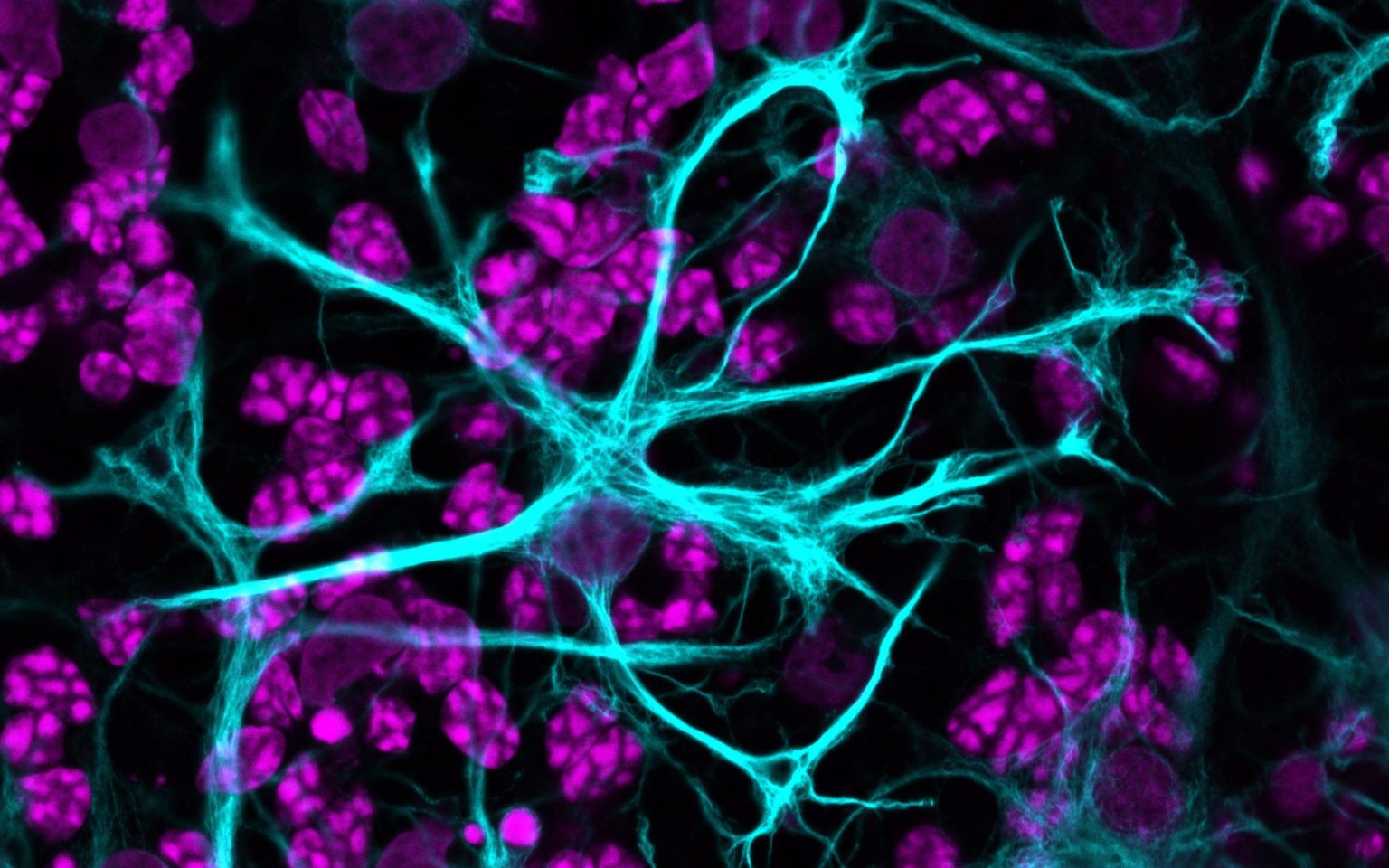 Colours in the dark: fluorescence microscopy for the classroom ...