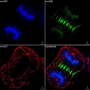 Shedding light on the gut microbiome – Science in School
