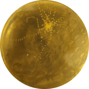 Footprints in the agar: growing bacteria from ants’ feet to combat ...